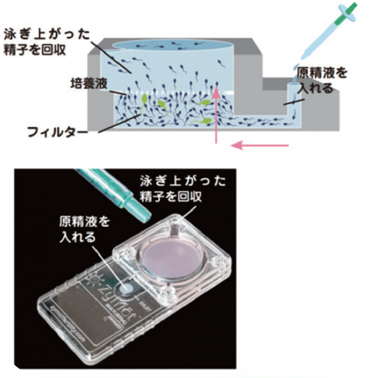 ZyMot（ザイモート）スパームセパレーター | 医療法人オーク会 不妊ブログ